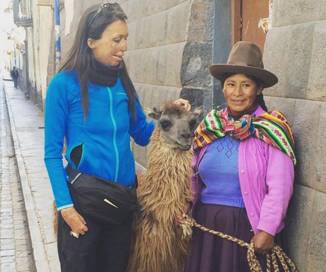 Turia Pitt is Australia's most inspiring woman