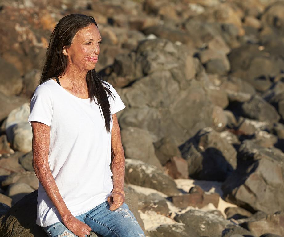 Turia Pitt inspirational moments