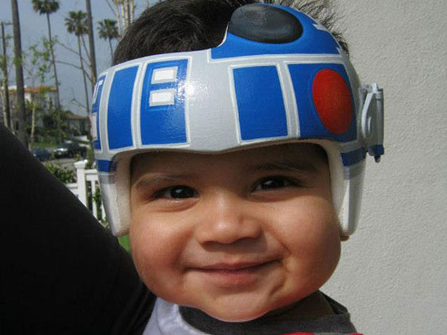 Artist makes kids' medical helmets look cool