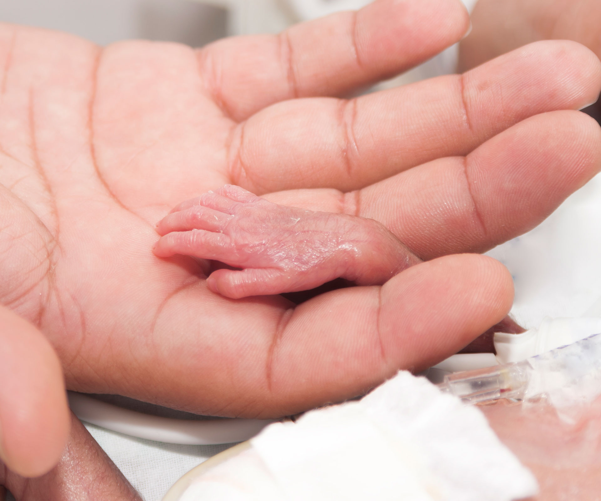 Emilia is the world’s tiniest baby to survive