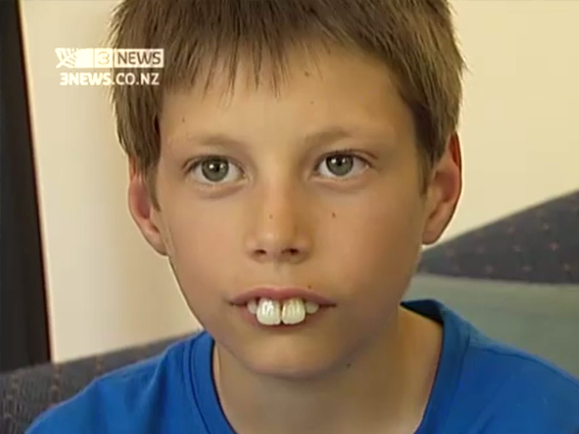 Buck-toothed boy gets a smile makeover
