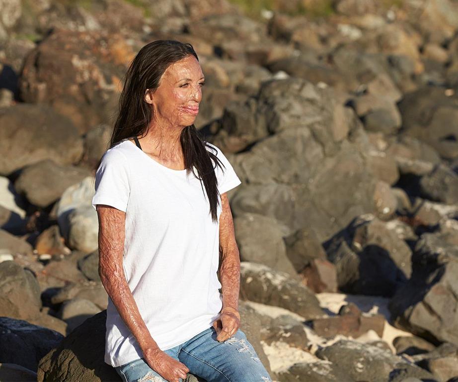 Turia Pitt reveals motherhood is her greatest joy