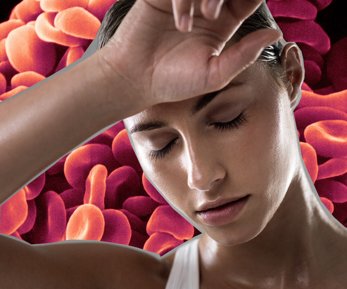 Meet the woman who literally sweats BLOOD