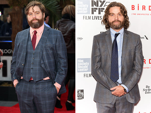 Drastic celebrity transformations