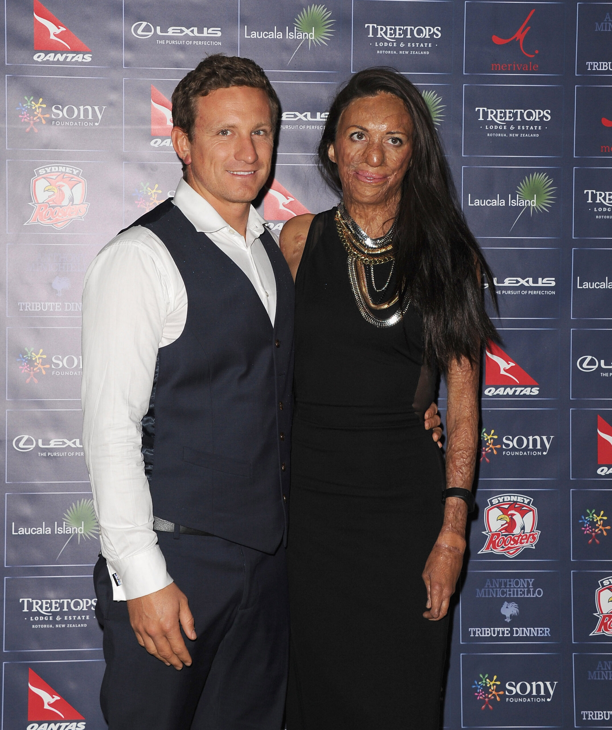 Turia Pitt on the best year of her life