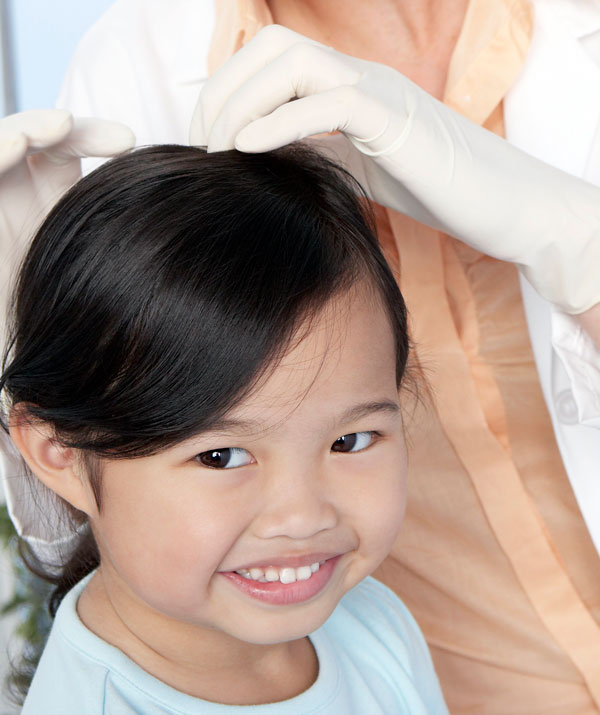 How to treat the new breed of 'super' head lice