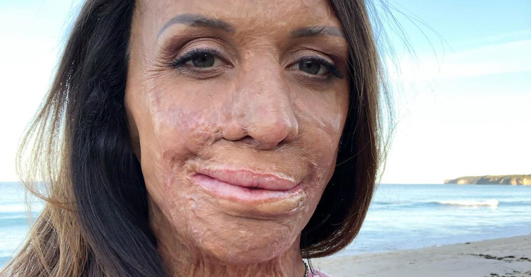 Turia Pitt reveals her health and fitness secrets