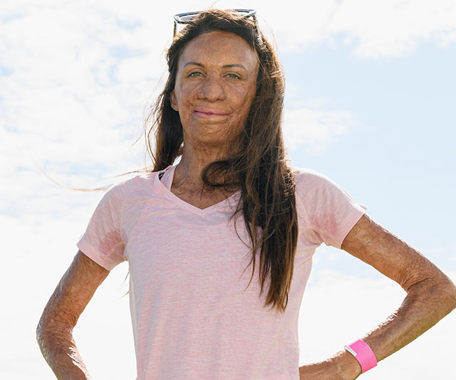 Tammin Sursok to play Turia Pitt in new biopic