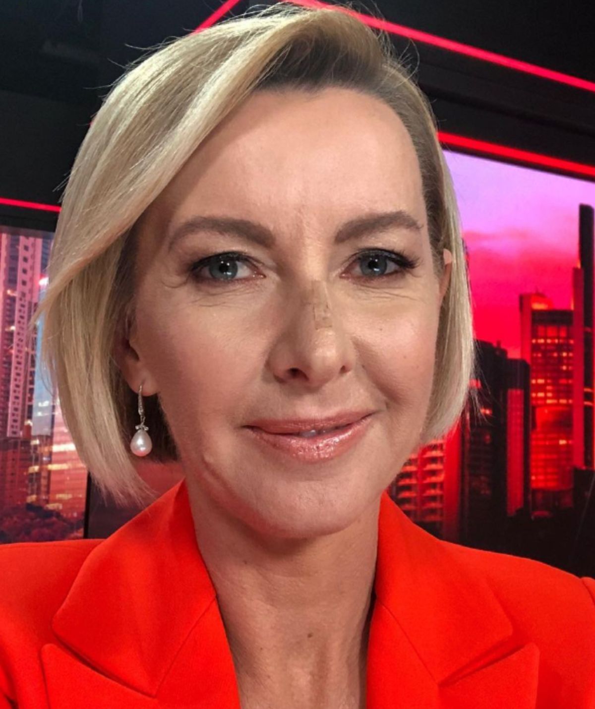 Deborah Knight's shocking Instagram of painful welts